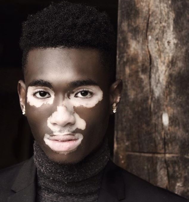 美不只有一種！20個證明「世界上並沒有絕對的美」獨特人類 | TEEPR 亮新聞