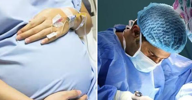 剖腹發現胎兒還太小 醫「縫回去」孕婦慘了 | TEEPR 亮新聞