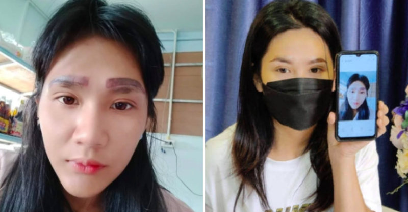 她霧眉竟「跑出4條眉毛」 一年後才有救 | TEEPR 亮新聞