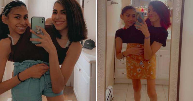 連體雙胞胎共用身體24年 姐交男友「妹無感當電燈泡」 | TEEPR 亮新聞