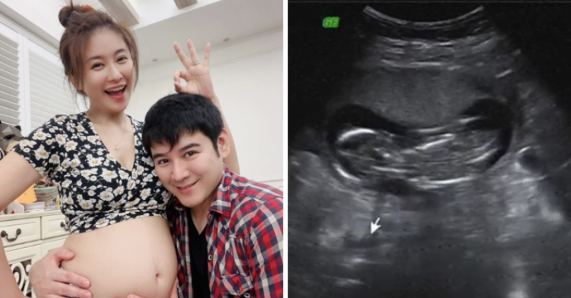 44歲葉家妤「宣布懷上第3胎」 與妹妹白家綺抱著哭 | TEEPR 亮新聞