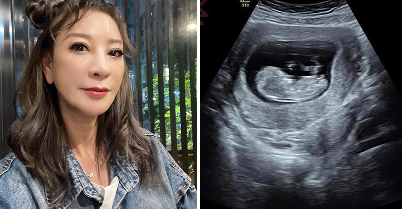 58歲楊繡惠曝喜訊！突曬「超音波照」求祝福：滿3個月再公開 | TEEPR 亮新聞