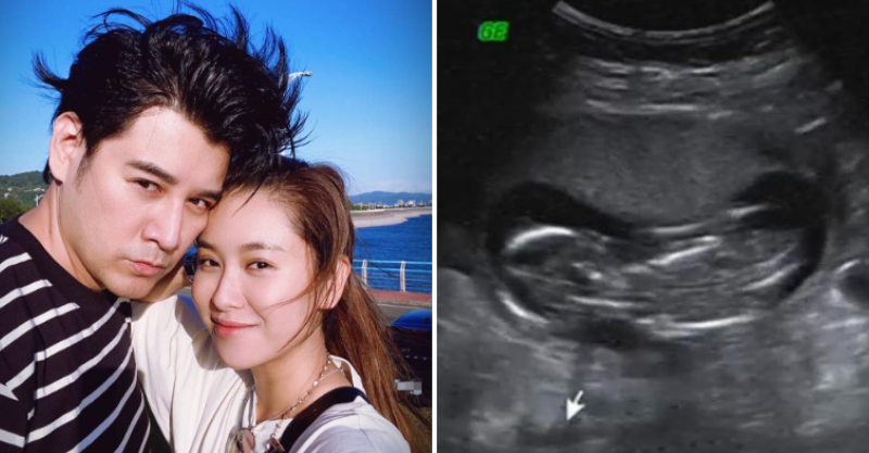 突懷第3胎！44歲本土女星辦「性別揭曉趴」 氣球一戳破親友全震驚 | TEEPR 亮新聞