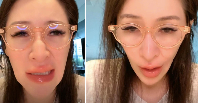 43歲台灣天后暴瘦「雙頰凹陷」網認不出來 她嘆要做手術：很辛苦 | TEEPR 亮新聞