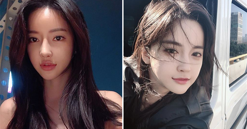 砸10億整成Angelababy！辣模爆「臉遭老闆打歪」 3年後近照曝光 | TEEPR 亮新聞