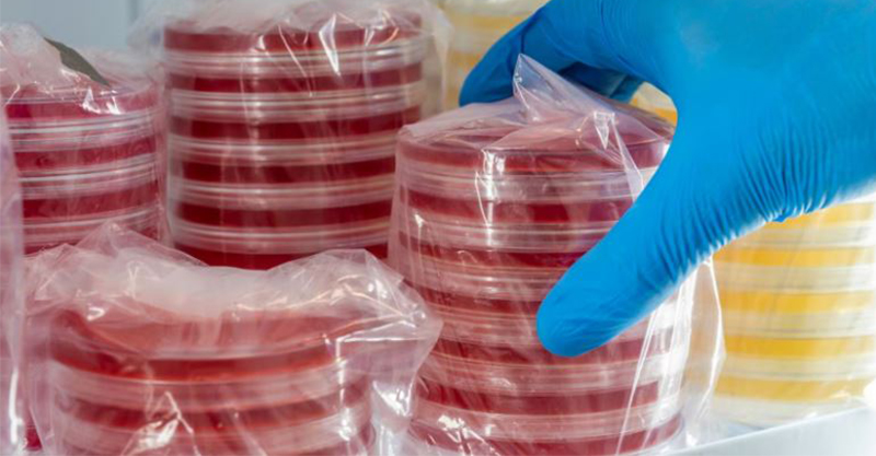 又爆神秘疾病！症狀「激似流感」已超過140死 WHO急發聲 | TEEPR 亮新聞