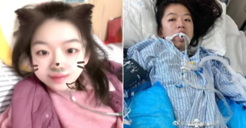 正妹網紅肺癌離世！曾割掉左肺續命 得年26歲 | TEEPR 亮新聞
